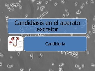 Candidiasis | PPTX