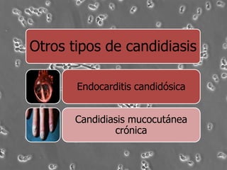 Candidiasis | PPTX