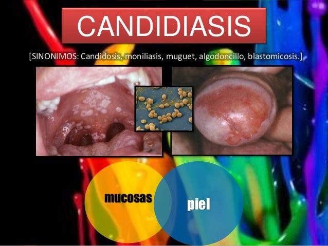 Candidiasis Genital En Adolescentes: Síntomas, Diagnóstico Y ...
