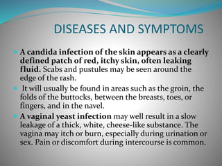 Candidiasis | PPTX