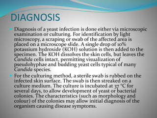 Candidiasis | PPTX