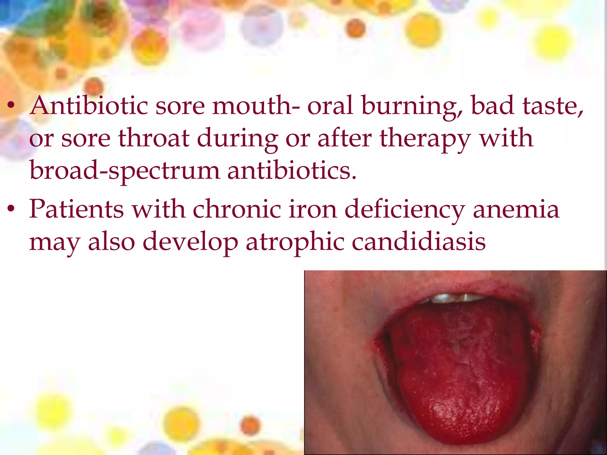 Candidiasis | PPTX