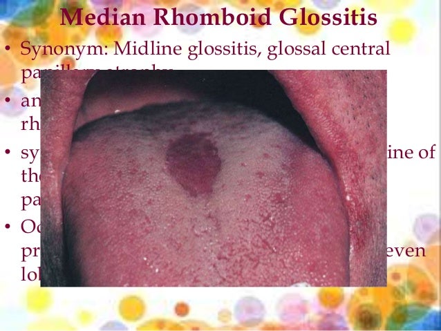 Candidiasis