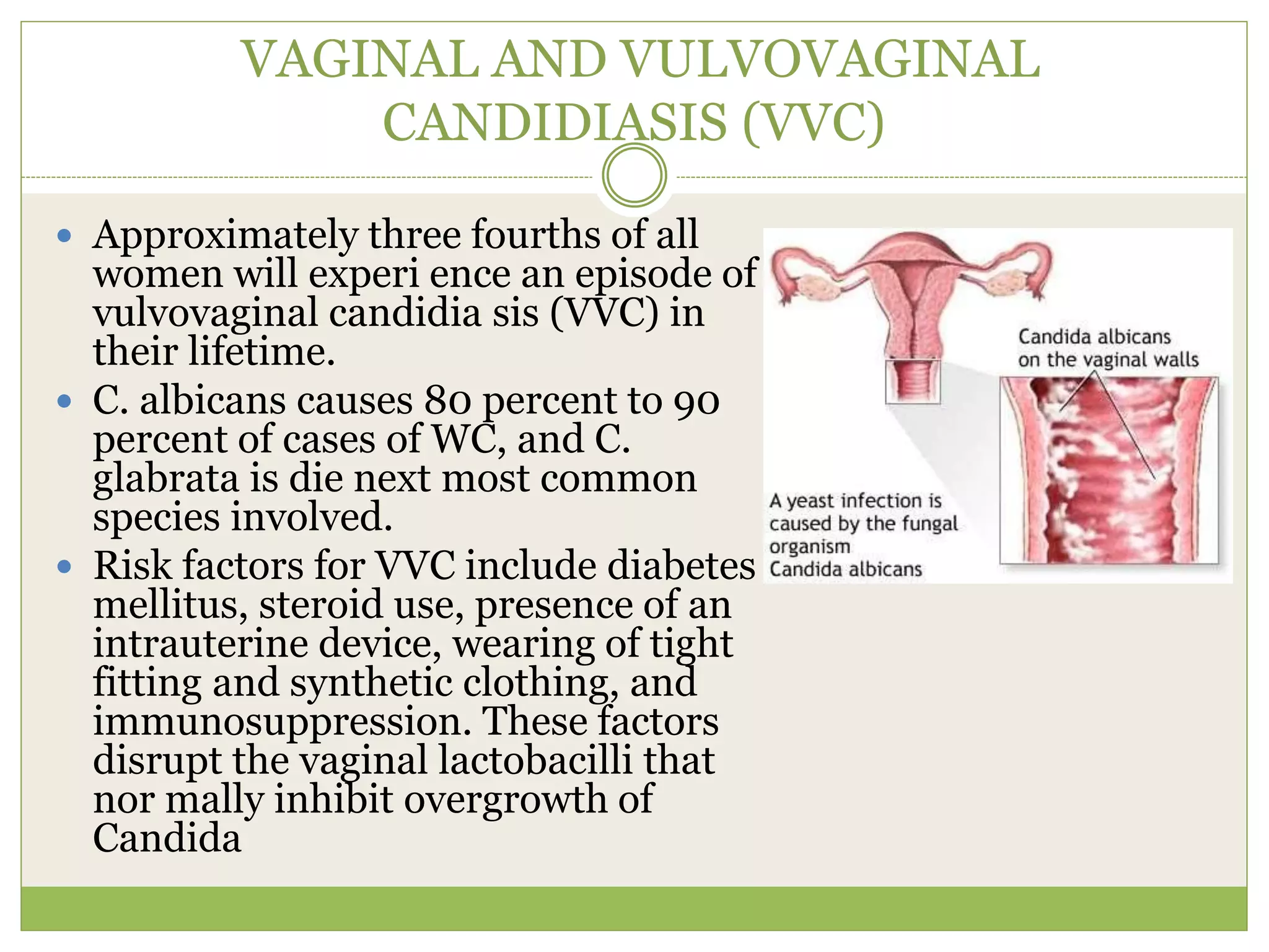 Candidiasis | PPTX