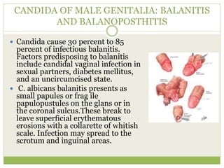 Candidiasis | PPTX