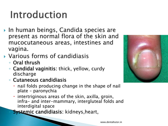 Candidiasis | PPTX | Dental Health | Diseases and Conditions