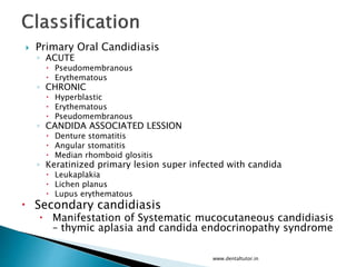 Candidiasis | PPTX