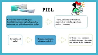 Candidiasis | PPTX
