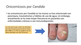Candidiasis | PPTX