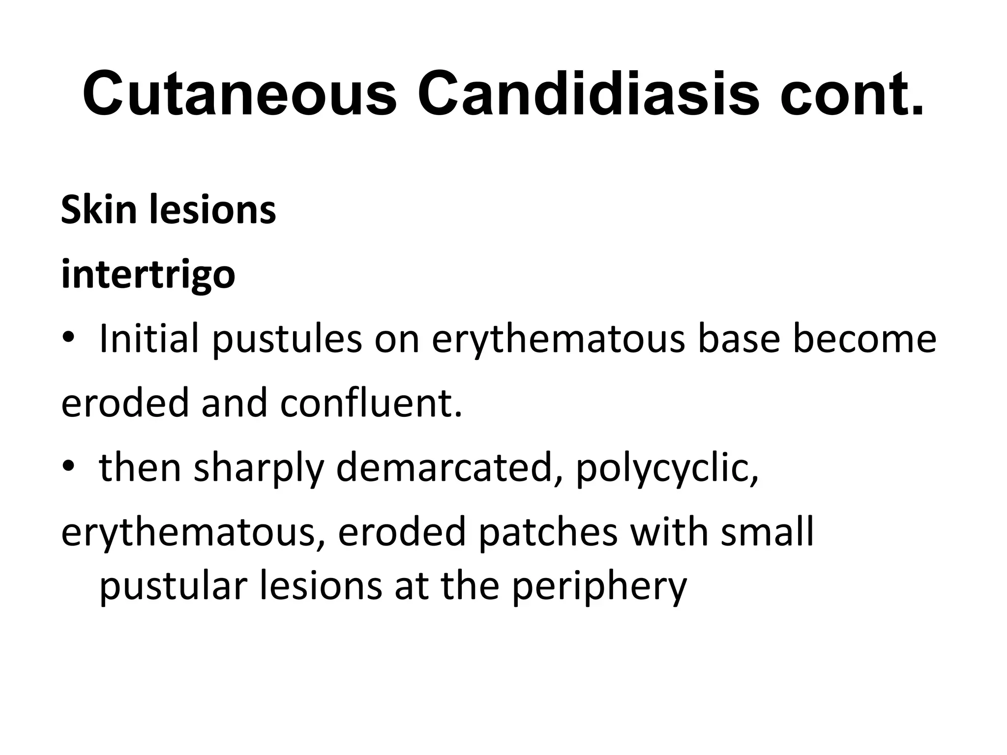 Candidiasis | PPTX