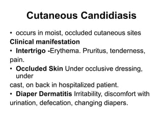 Candidiasis | PPTX