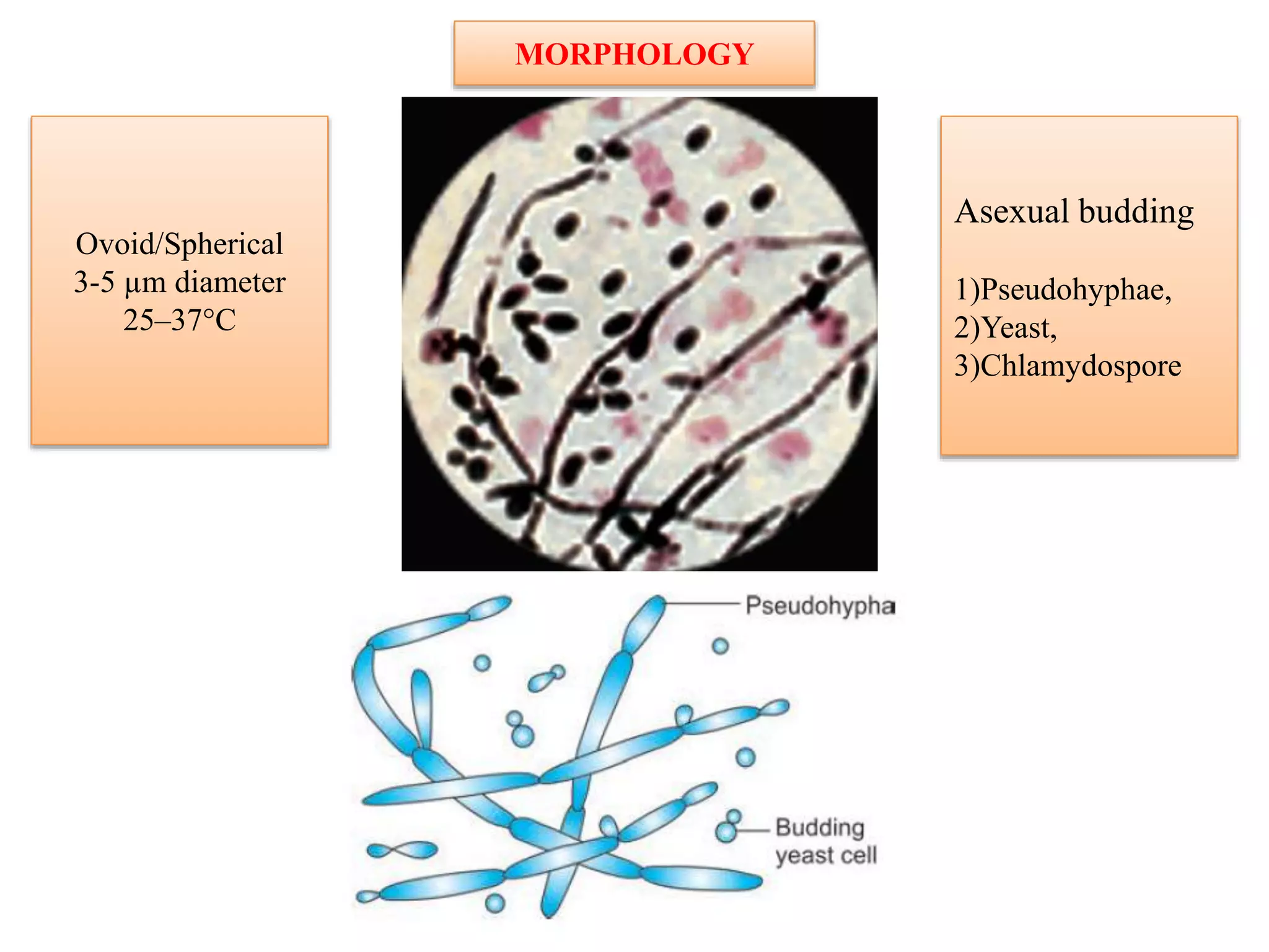 Candidiasis and its management in dentistry | PPTX