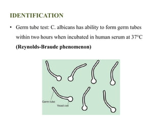 Candidiasis and its management in dentistry | PPTX