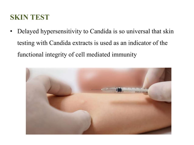 Candidiasis and its management in dentistry | PPTX | Skin and Dermatology | Diseases and Conditions