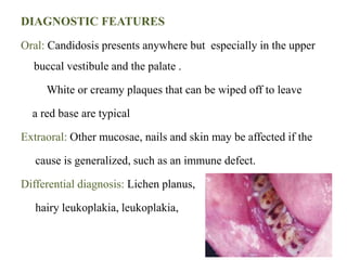 Candidiasis and its management in dentistry | PPTX