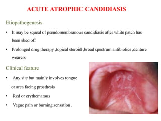 Acute Atrophic Candidiasis
