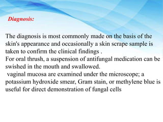 Current Developments in Prevention and Treatment of Candidiasis | PPTX