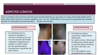 Candidiasis.ppt