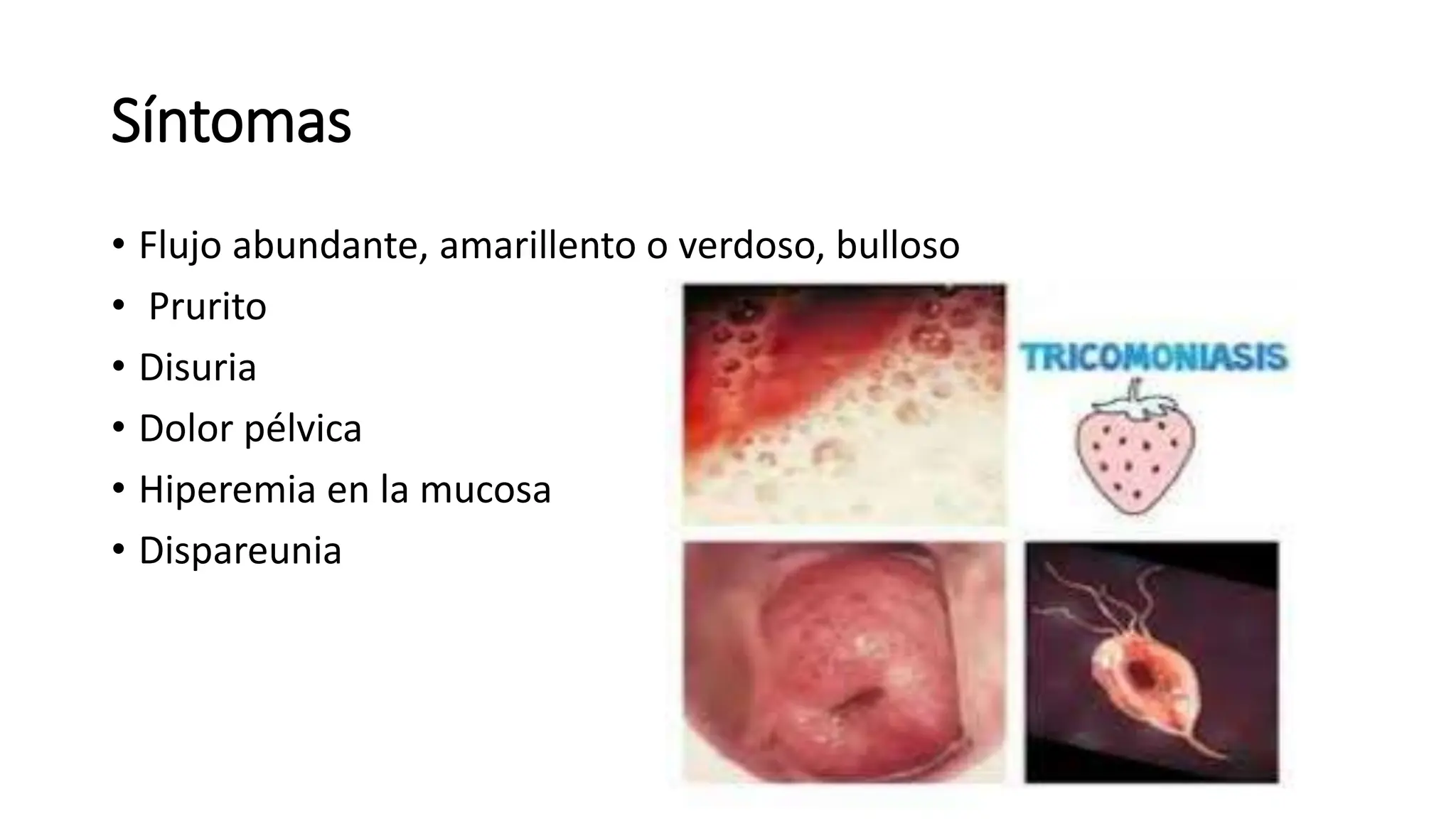 Flujos Vaginales, candidiasis, vaginosis bacteriana | PPTX