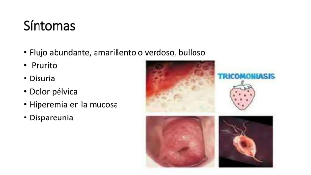 Flujos Vaginales, candidiasis, vaginosis bacteriana | PPTX