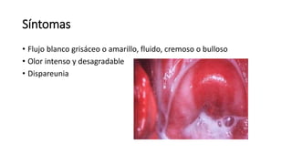 Flujos Vaginales, candidiasis, vaginosis bacteriana | PPTX