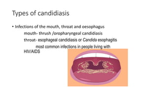 ORAL, VAGINAL CANDIDIASIS AND CANDIDEMIA.pptx