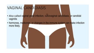 ORAL, VAGINAL CANDIDIASIS AND CANDIDEMIA.pptx
