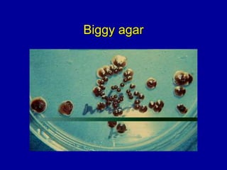 Candidiasis fungal disease crop site.ppt | Free Download