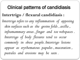 Candidiasis.pptx Azizullah Aziz Abdali university | PPT