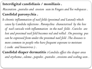 Candidiasis.pptx Azizullah Aziz Abdali university | PPT