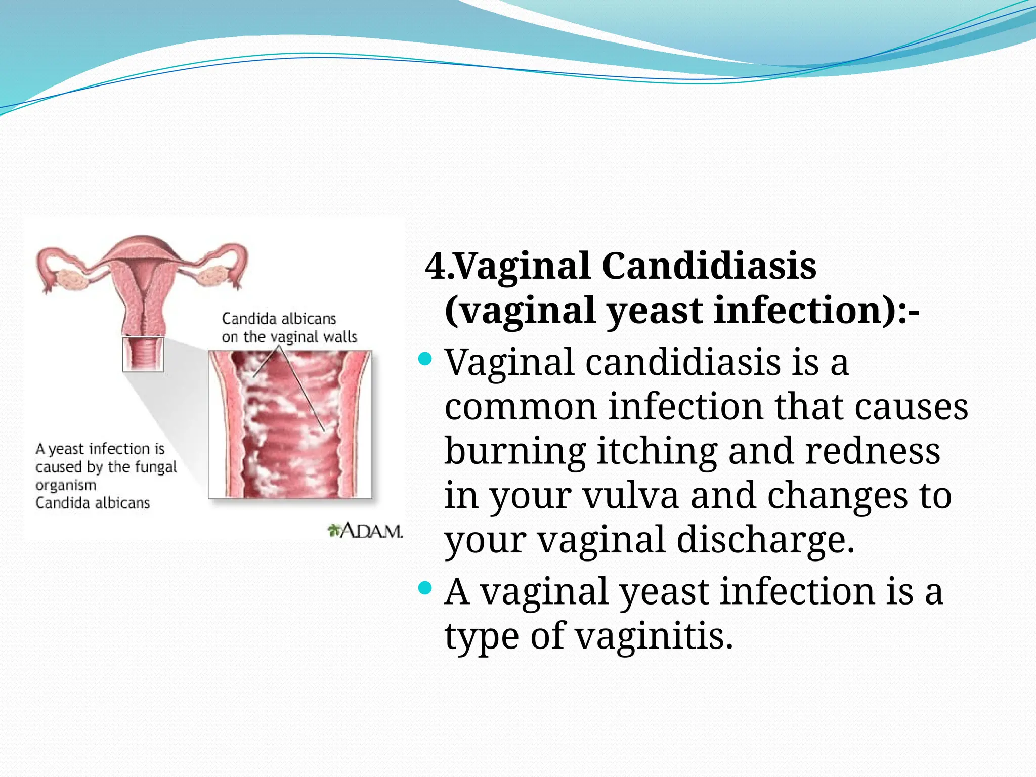 Candidiasis is fungal infection that.pptx