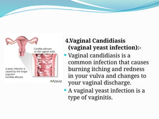 Candidiasis is fungal infection that.pptx