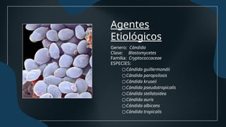 Candidiasis, enfermedades micoticas.pptx