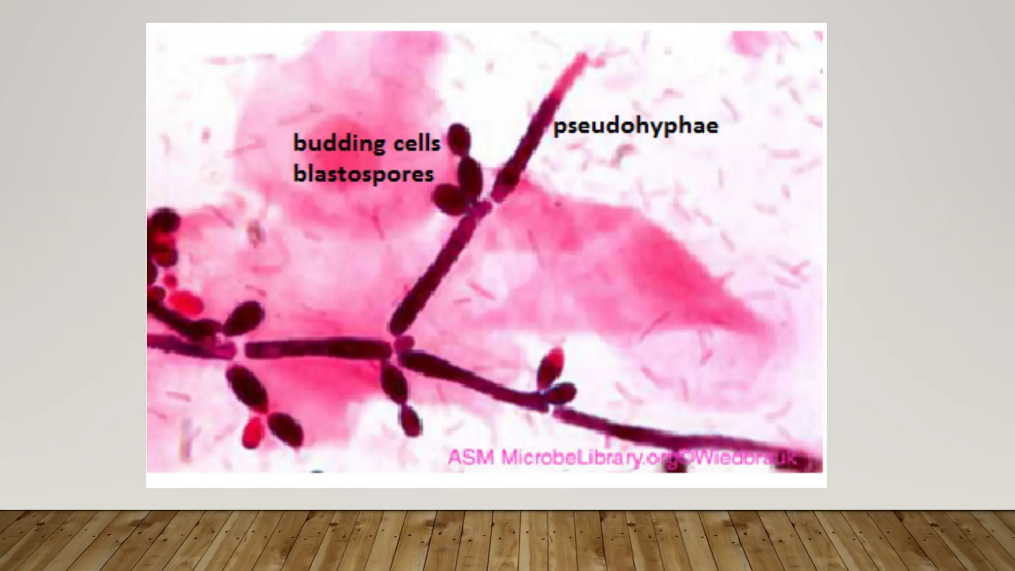 CANDIDIASIS: VIRULENCE FACTORS, PATHOGENESIS & LABORATORY DIAGNOSIS | PPTX