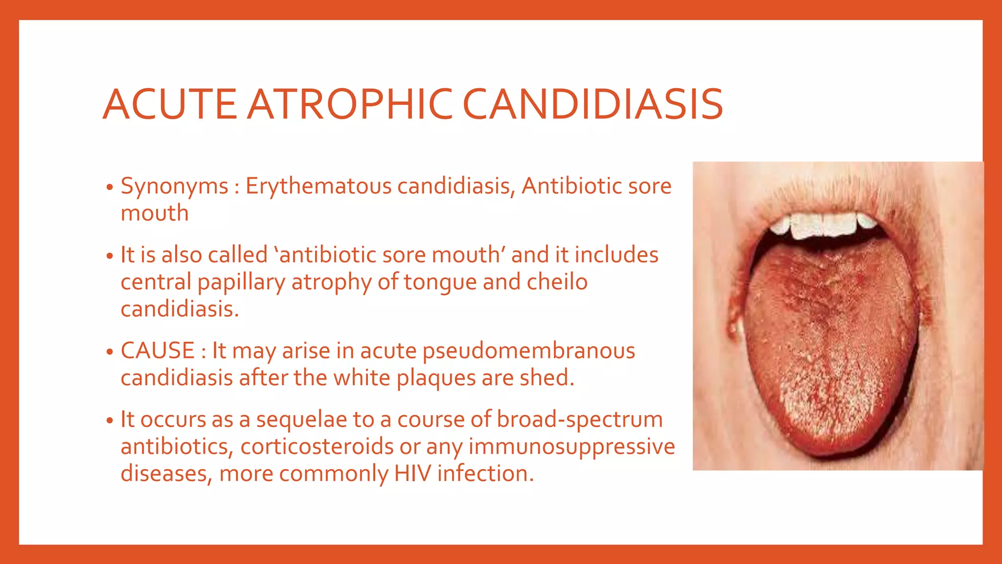 Candidiasis | PPTX