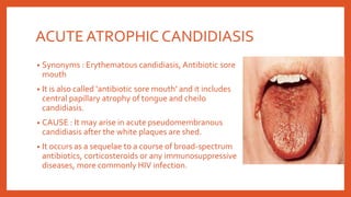 Acute Atrophic Candidiasis