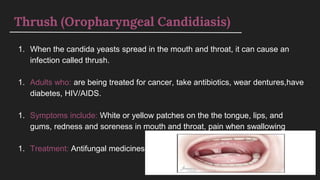 Candidiasis - Simran sakeena .pptx