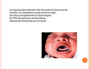 Candidiasis 1 | PPTX