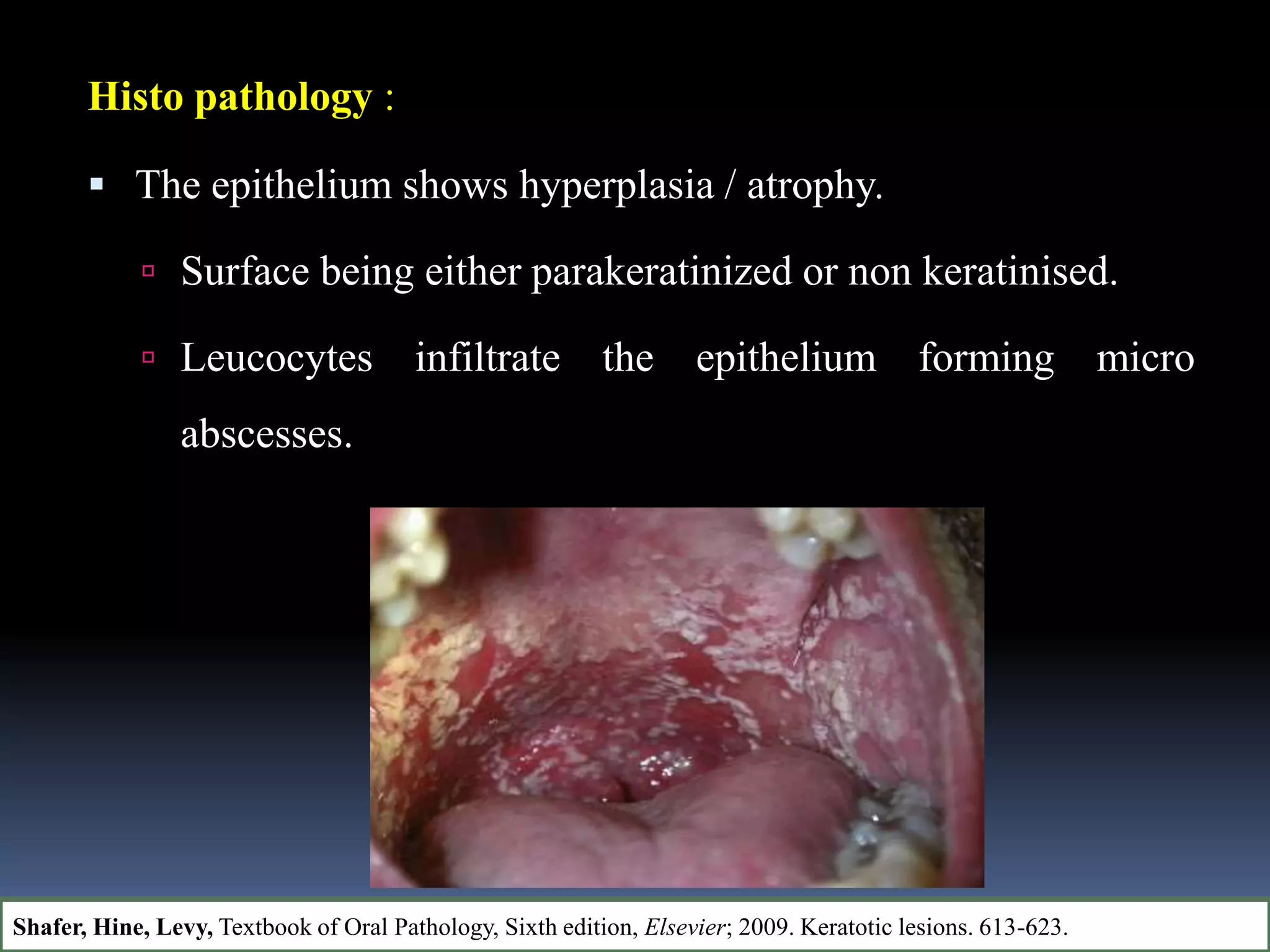 Candidiasis | PPT