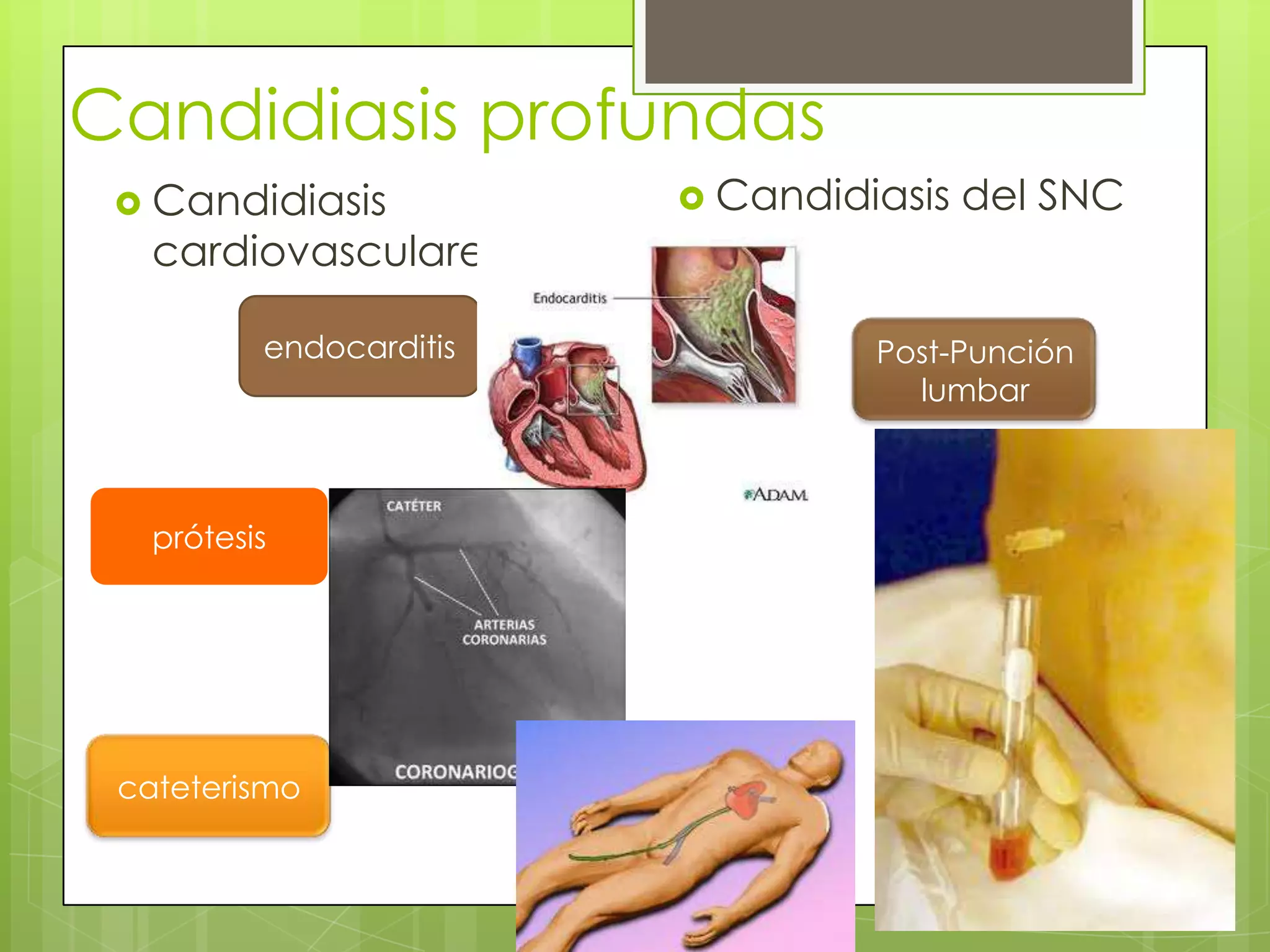 Candidiasis casi listo | PPTX