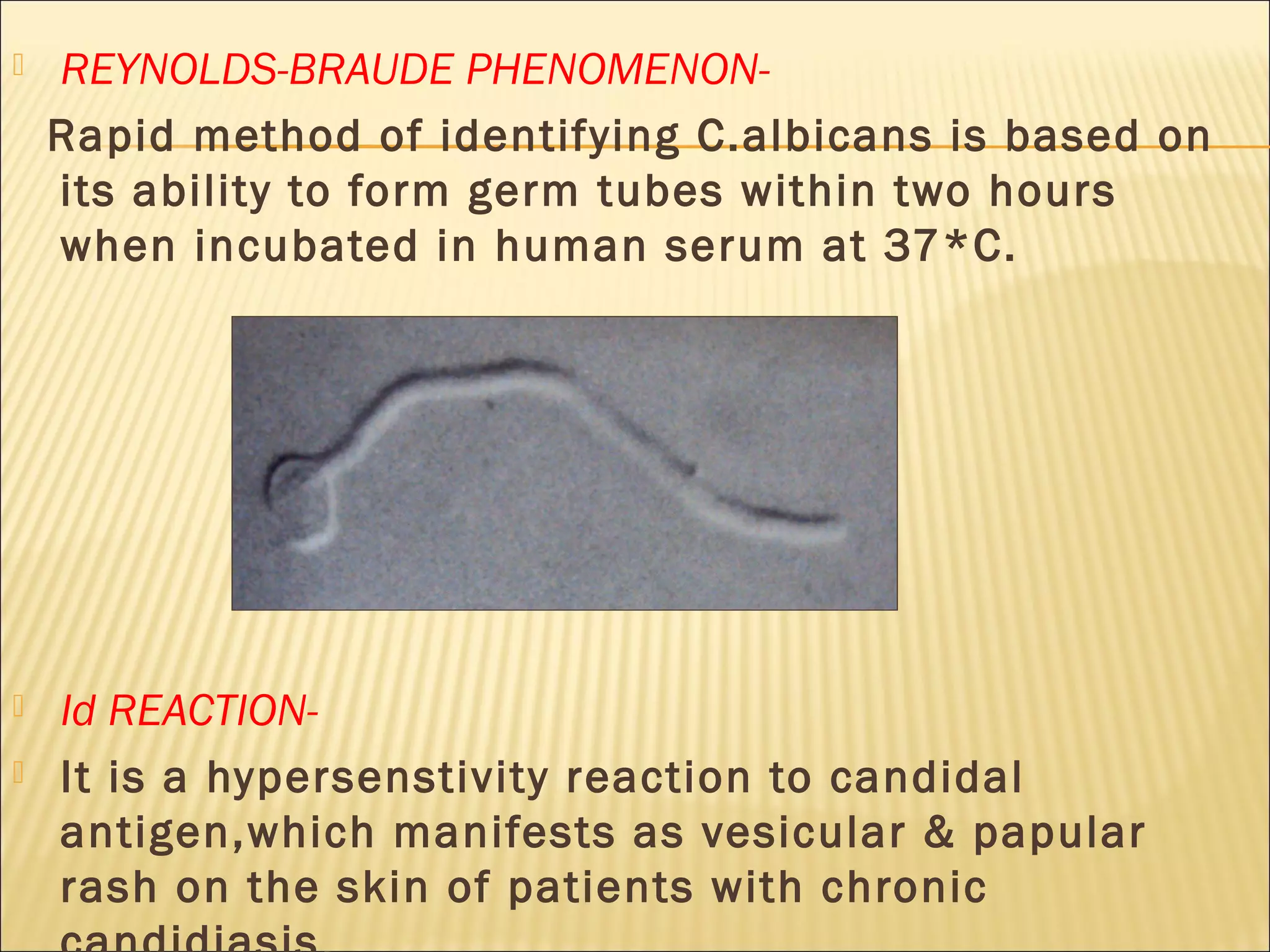 Mycotic Infections of the Oral cavity . ( Candidiasis ) | PPT