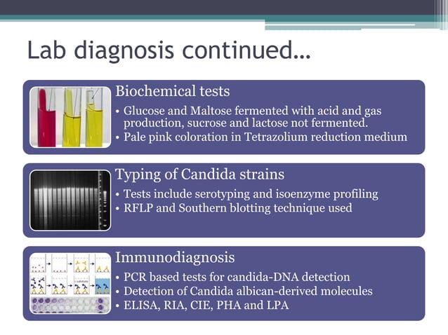 Candidiasis – clinical manifestations and lab diagnosis of oral ...