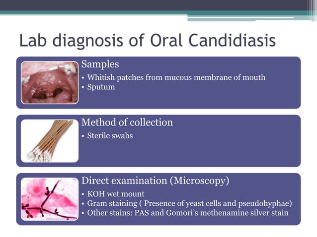 Candidiasis – clinical manifestations and lab diagnosis of oral ...