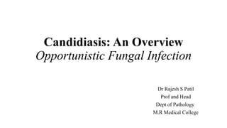 Candidiasis An overview Dr Rajesh Patil Sir.pptx