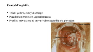 Candidiasis An overview Dr Rajesh Patil Sir.pptx