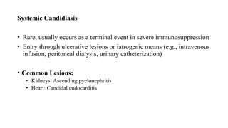 Candidiasis An overview Dr Rajesh Patil Sir.pptx
