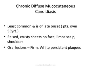 Oral Mycotic Infections Candidiasis (Candidosis, Moniliasis, Thrush ...