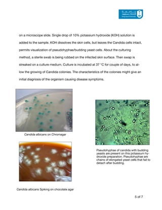 Candidiasis infections | PDF