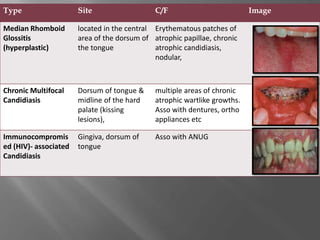 Candidiasis jc | PPTX