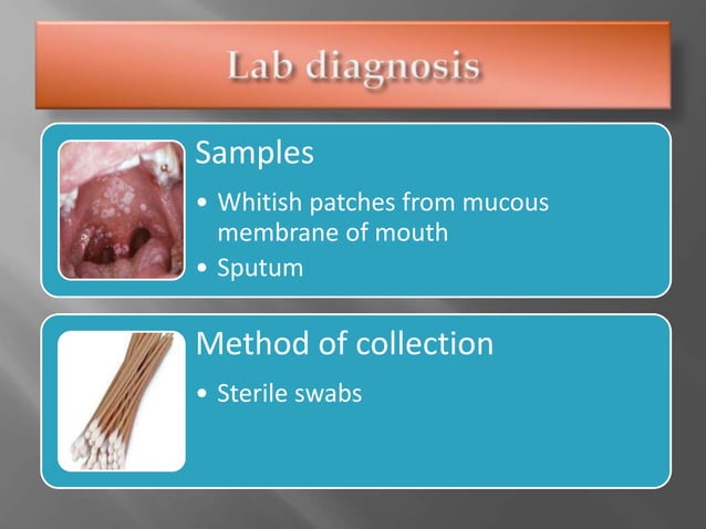 Candidiasis jc | PPTX | Ear, Nose and Throat Conditions | Diseases and ...